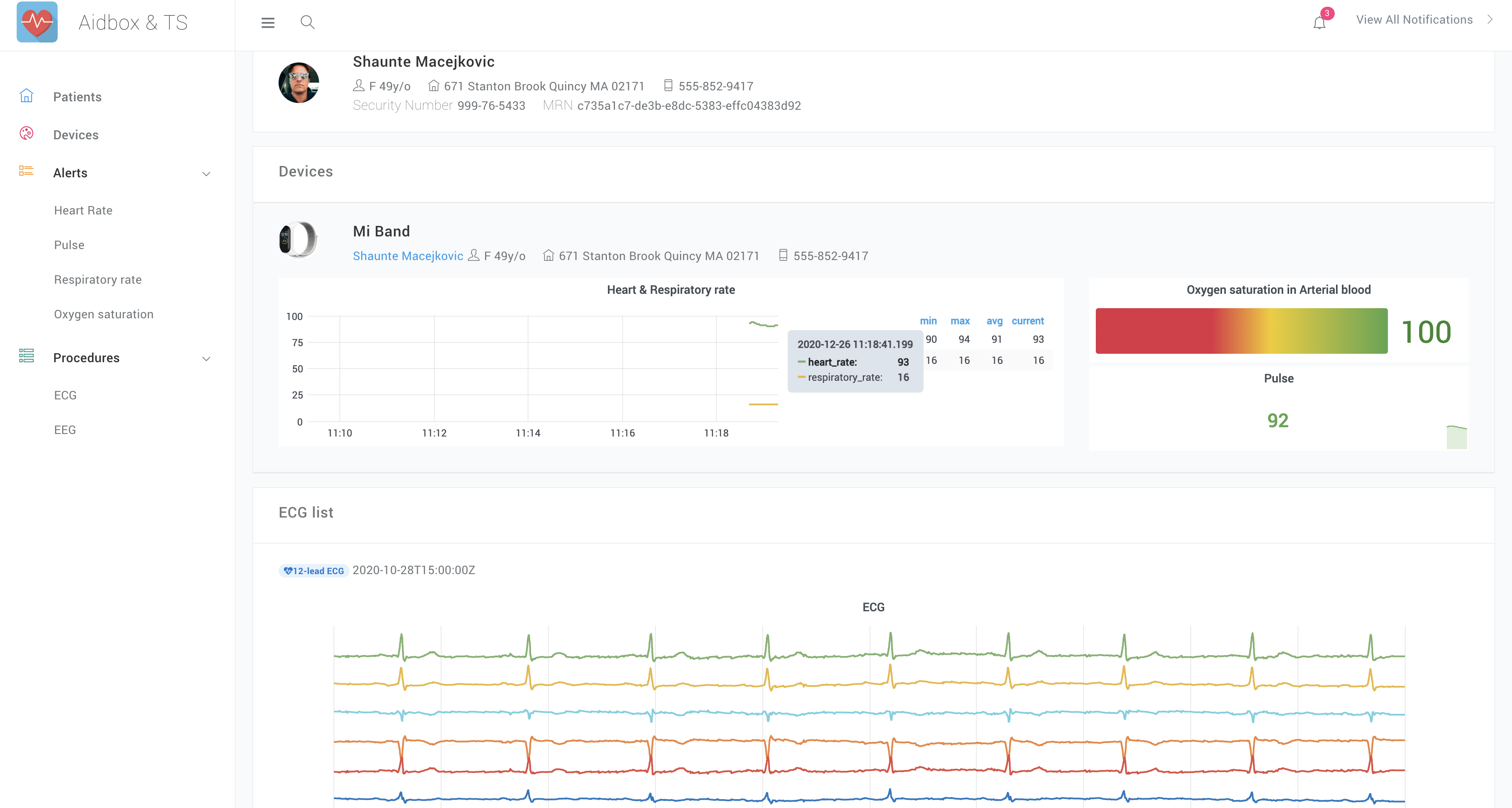 Article: Bringing data from wearables and medical IoT devices to FHIR ...